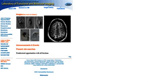 Lfmi Home Page Lfmi Ninds Nih