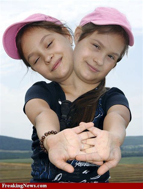 Image Detail For Two Headed Twins Pictures Strange Two Headed Twins