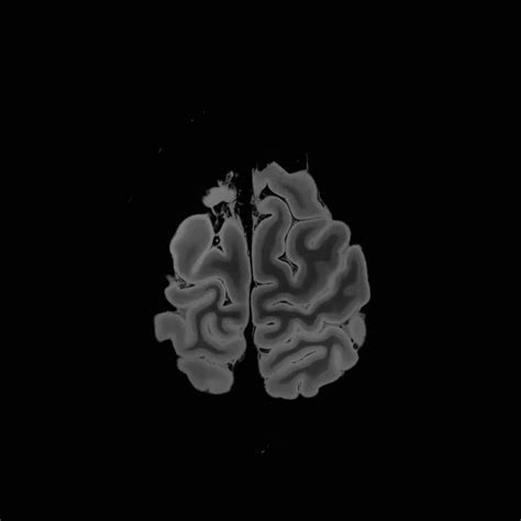 [video] Sofia Matta Md On Linkedin Neuroimaging Militarymedicine Specialforces
