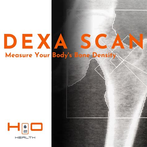 Its Crucial To Know Your Bone Density As You Grow Older 🦴 As Bones