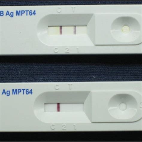 Mycobacterium Tuberculosis Growth On Lowenstein Jensen Medium