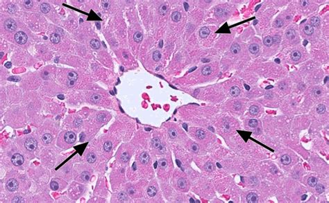 Figure 9 Higher Magnification Of Figure 8 Hande Ntp Technical