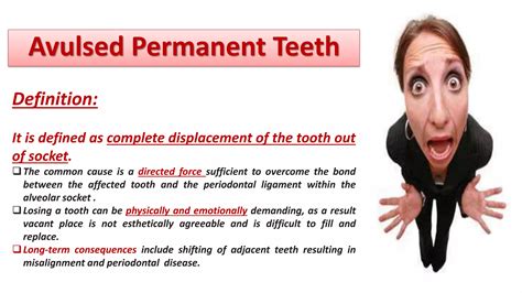 Tooth Avulsion Pdf