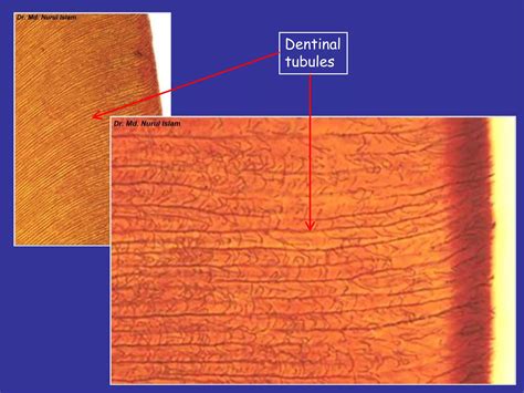 Dentin Pulp Complex Pptx