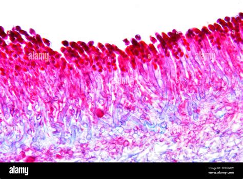 Phylum Ascomycota Microscope