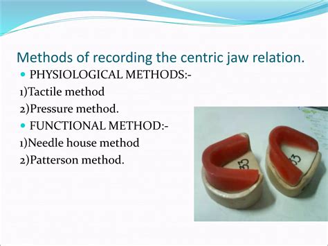 Centric Jaw Relation By Dr Rajanikanth Av Ppt