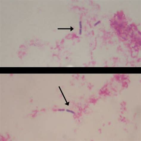 Bacillus Cereus Growth In Macconkey Agar Plate Download Scientific