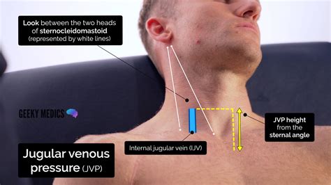 Jugular Venous Pressure Jvp Measurement Waveforms Geeky Medics