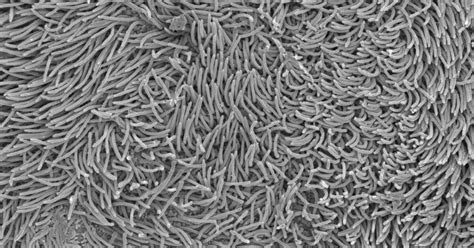 Techtalk Qanda With Steph Stowers Institute For Medical Research