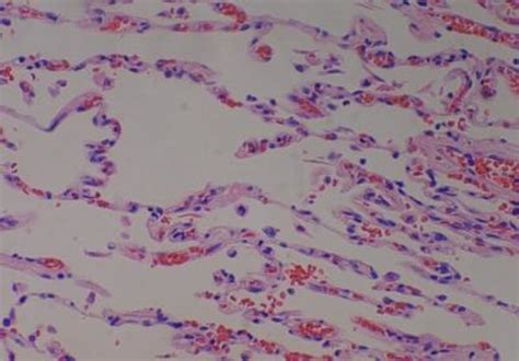 Novus Biologicals Human Lung Tissue Microarray Normal Human Lung
