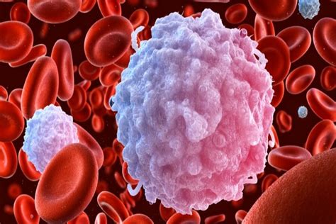 Lökosit Lenfosit Yüksekliği Nedir Güncel Oku