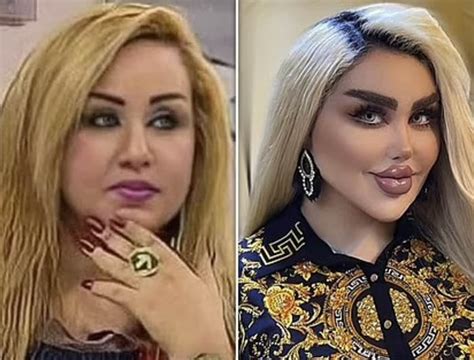 Baghdad Born Dalia Naeem 29 Ive Had 43 Cosmetic Procedures Goftar News