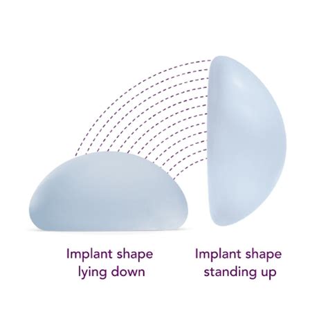Motiva® Implants For Breast Augmentation Everything You Need To Know