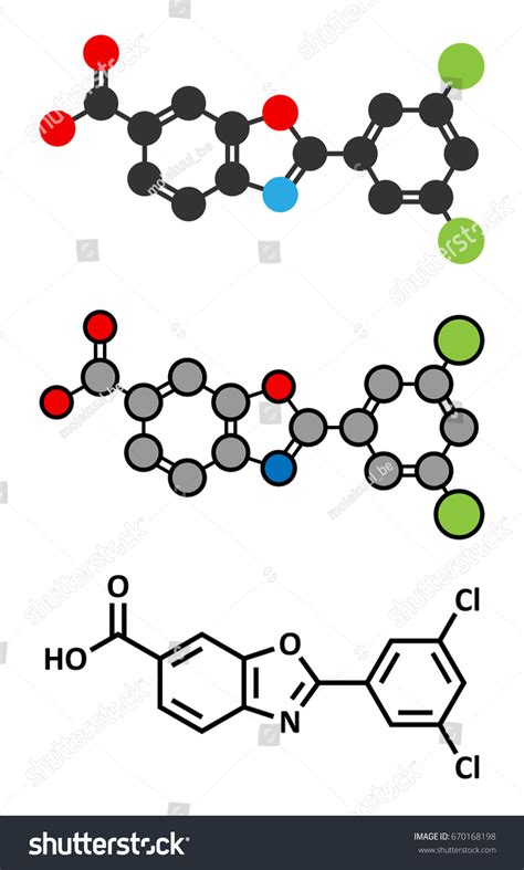 Familial Amyloid Polyneuropathy Over 32 Royalty Free Licensable Stock Illustrations And Drawings