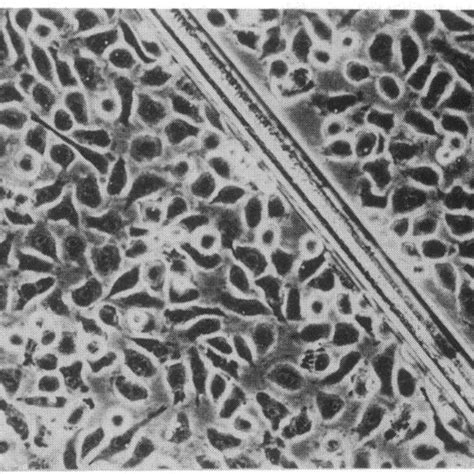 Intercellular Gap Junctional Communication In Rat 13762nf Mammary Download Scientific Diagram