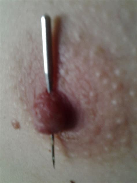 Nadeln 20 Pics Xhamster