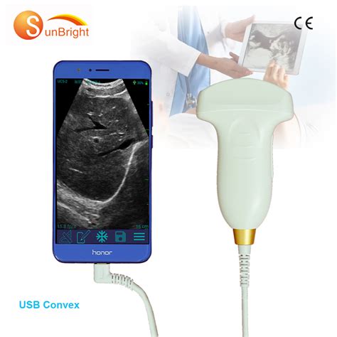 Ecografo Portatil Usb Convex Probe Portable Color Doppler Sale Ultrasonido Portatil Usb Convex