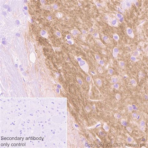 Dopamine Receptor D1抗体 1 1 F11 Se6 Bsa And Azide Free Ab256556