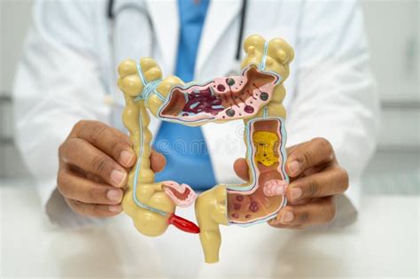 Intestine Appendix And Digestive System Doctor Holding Anatomy Model