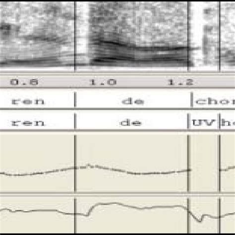 A Typical Segmentation Results Of The Tokenization Front End Download