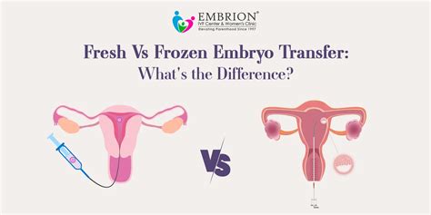 Whats The Difference Between Fresh Vs Frozen Embryo Transfer