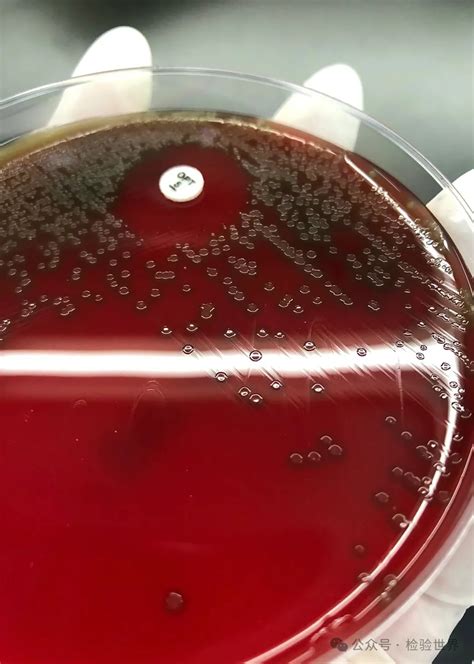 肺炎链球菌的形态特性、培养鉴定及致病机制解析 环凯微生物官网
