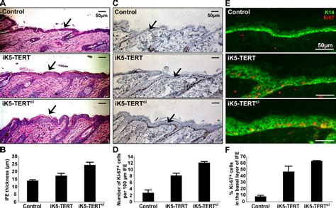 Both Tert And Tertci Enhance Proliferation Of Interfollicular Epidermis Download Scientific