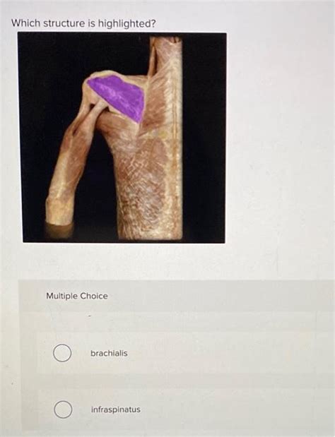 Solved Which Structure Is Highlighted Multiple Choice