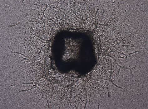 Aortic Ring Assay Analysis Image Analysis Imagesc Forum