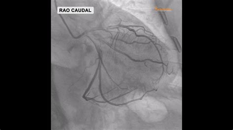 Innvolution Healthcare Private Limited On Linkedin Innvolution