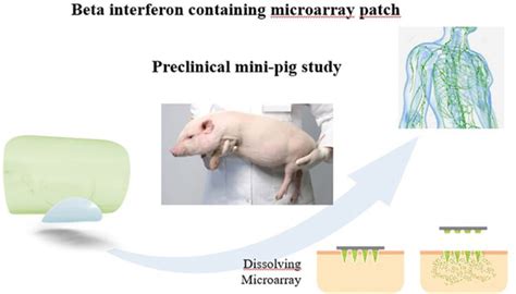 A Promising Alliance In Multiple Sclerosis Treatment Microarray Patch