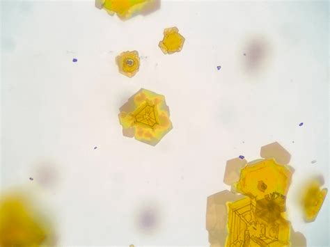 Lead Iodide Crystals Under A Microscope Rchemistry