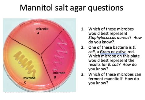 Answered Mannitol Salt Agar Questions Bartleby