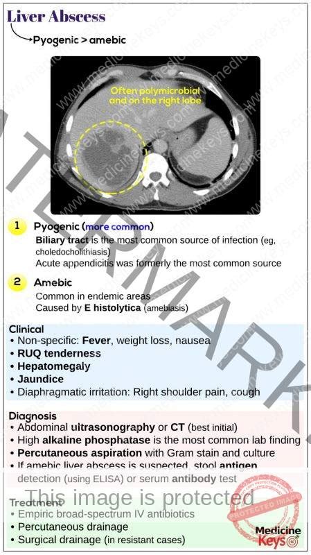 Liver Abscess Medicine Keys For Mrcps