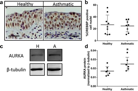 Expression Of Creb Binding Protein Crebbp And Aurora Kinase A Aurka