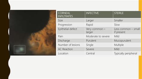 Peripheral Corneal Diseases Pptx Peripheral Corneal Diseases Pptx