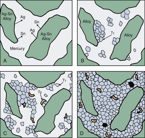 Classification Of Amalgam At Van Flores Blog