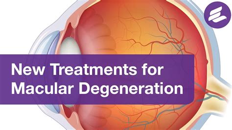 Treatment For Macular Degeneration Injections At Yvonne Tandy Blog