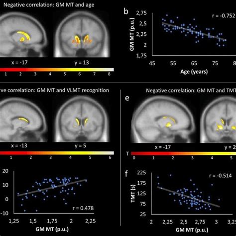 manual segmentation of an individual sn vta within the midbrain the