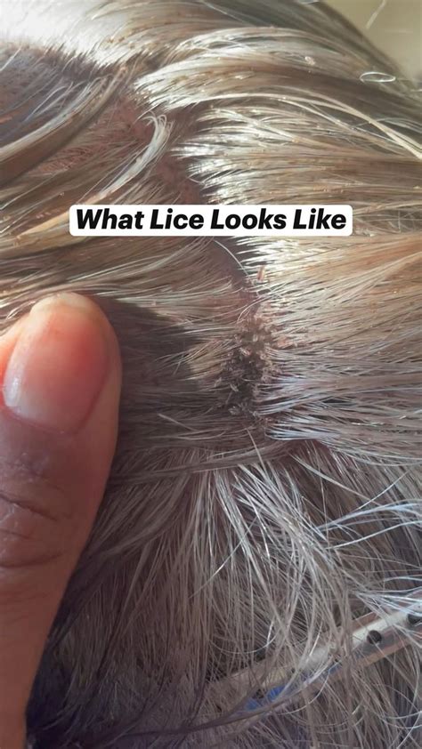 What Lice Looks Like Hairstyles For School Hair Tutorial Easy