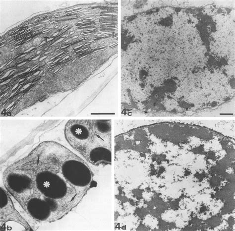 Chloroplast Micrograph