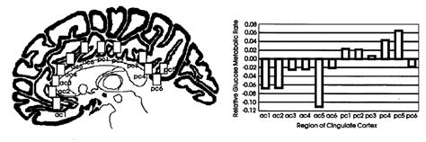 Sagittal View Of The Cingulate Cortex A And Differences In Relative