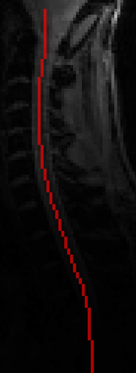 get centerline finds the centerline but deepseg fails to find the sc