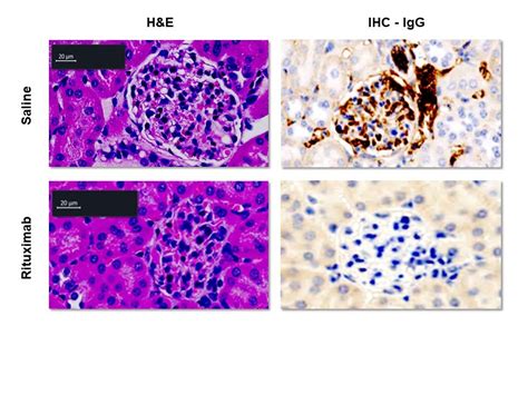 Systemic Lupus Erythematosus Sle — Invivocue Leading Expert In Humanized Technology For Cell