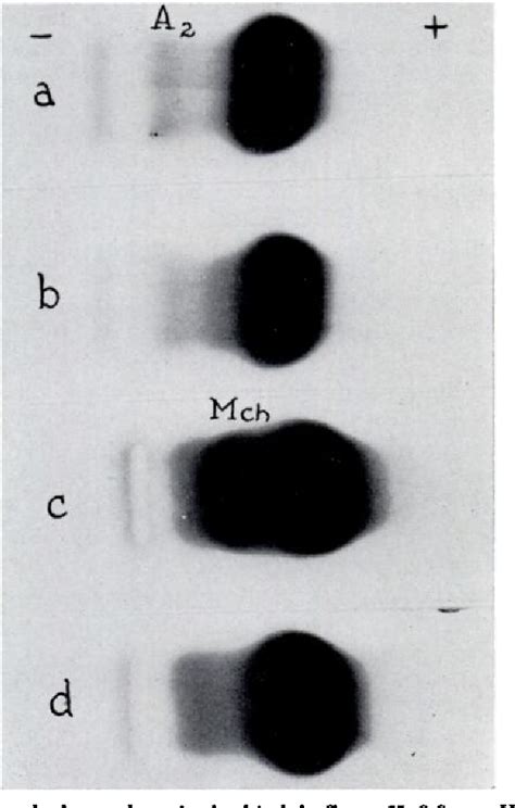 Figure 1 From Hemoglobin A New Variant Of Hemoglobin Semantic Scholar