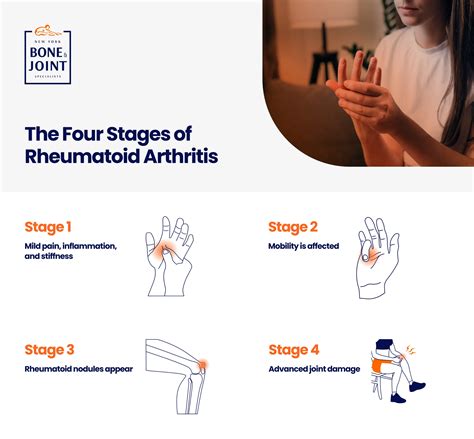 How Do You Get Rid Of Rheumatoid Nodules