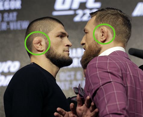 Oreja De Coliflor Una Deformación Que Acompaña A Luchadores Y A