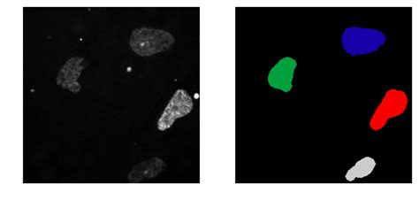 Individual Amoeboid Cells Imaged Via Brightfield Microscopy Are Download Scientific Diagram