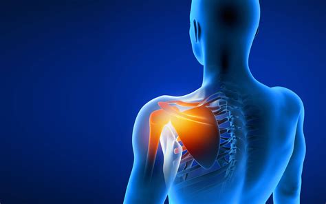 Brachial Plexus Injury Symptoms Treatment And Causes Ifar