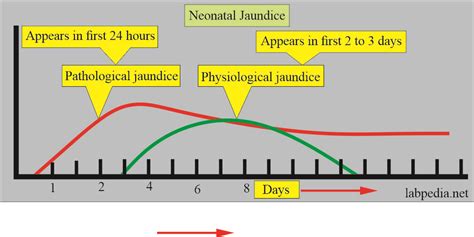Neonatal Jaundice Classification And Diagnosis
